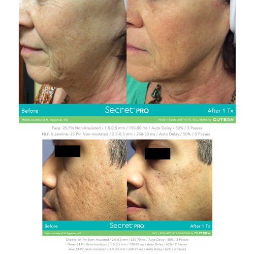 Secret Pro - Medical Skin Clinic - Donegal